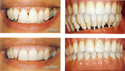 Zahnarzt Düsseldorf Parodontologie Willemsen Strugala